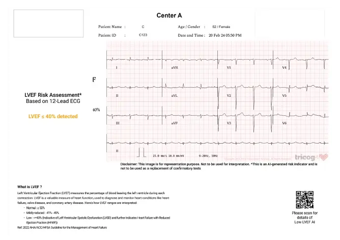 Campaign GA | 12 Lead ECG Machine | Tricog Health